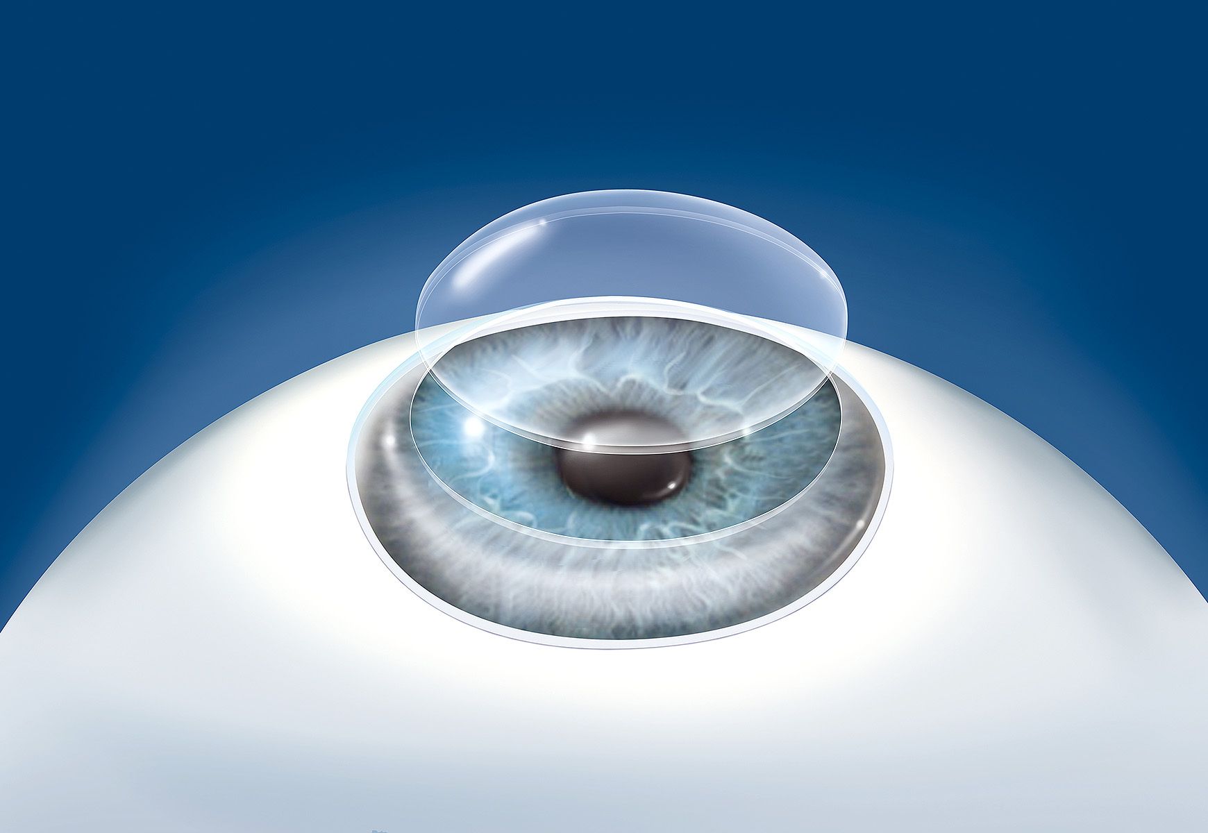 How Does It Work? - Image 3 from Behind Tiny's Eyes: The 411 on ...