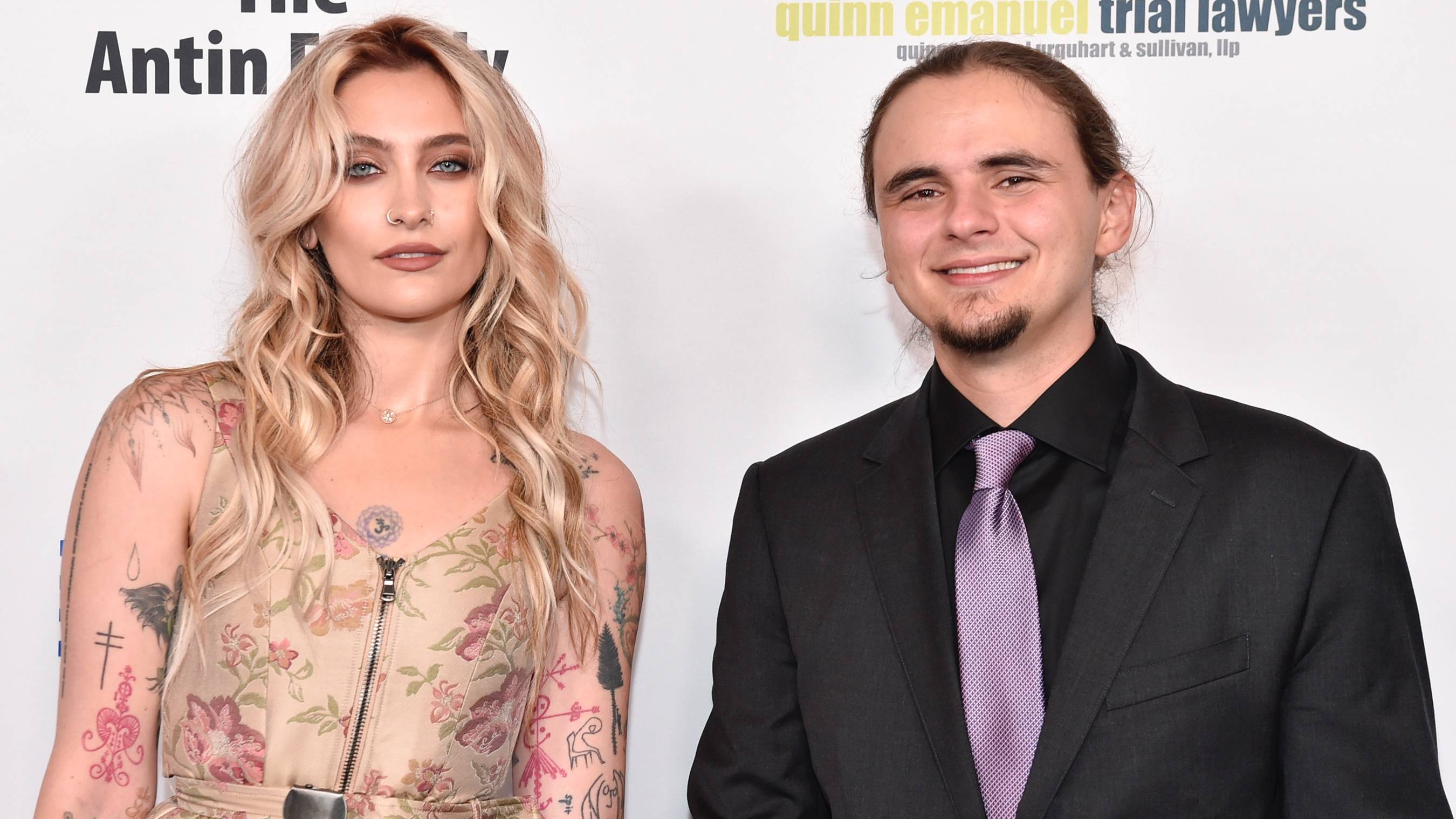 Michael Jackson Son Prince Has Vitiligo