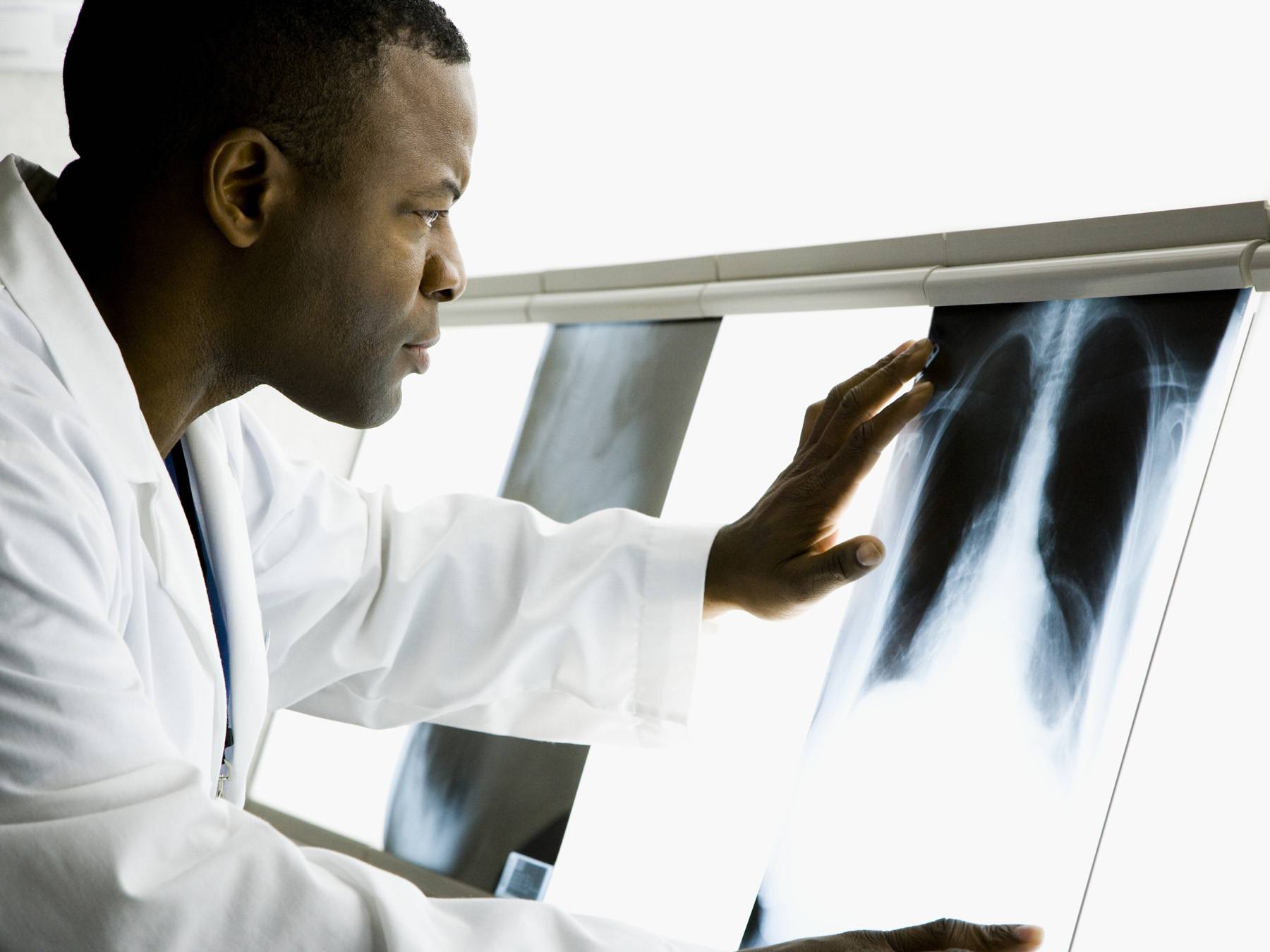 March 24 Is World - Image 1 from The 411 on Tuberculosis | BET