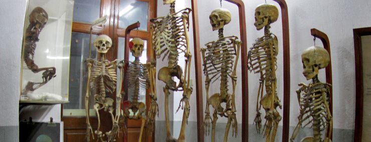Bangkok Forensic Museum, Thailand - Image 6 from Top 10 Creepiest ...