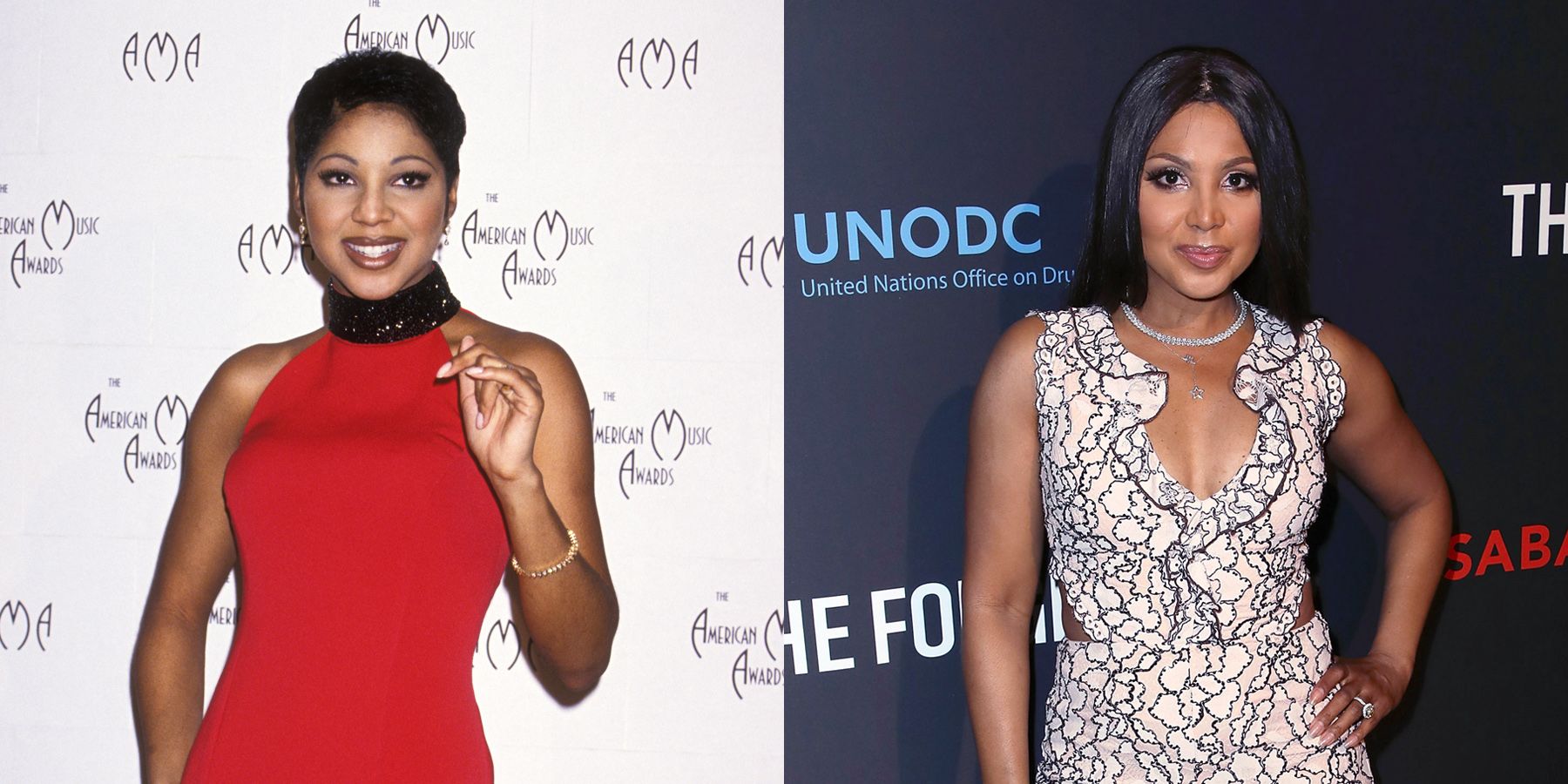Toni Braxton - Toni - Image 21 from Nip and Tuck: Celebrity Plastic ...