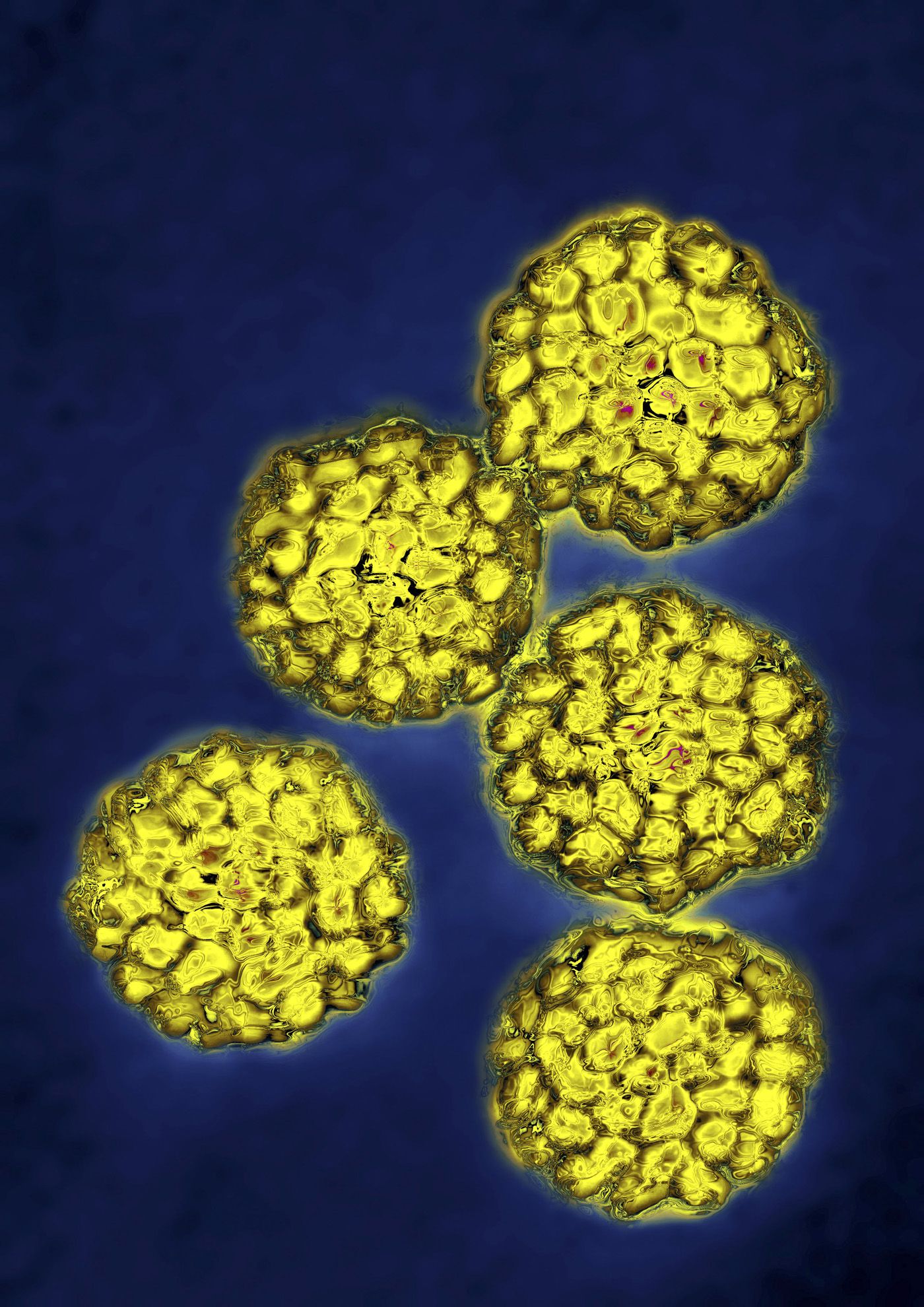 Not All STDs Are - Image 6 from What You Need to Know About STDs Now | BET