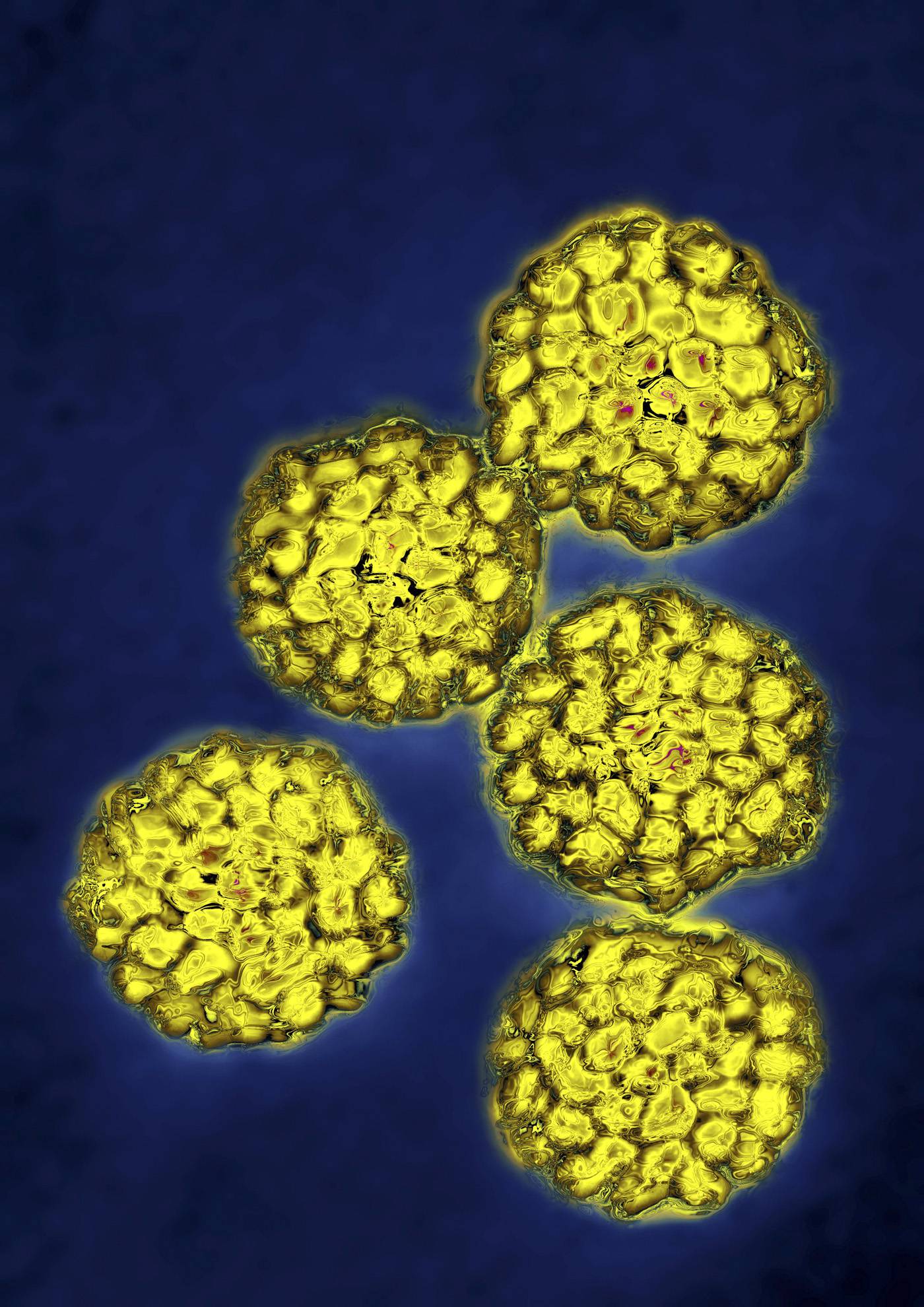 What Is HPV? - - Image 2 from HPV 101: What You Need to Know | BET