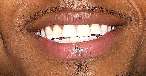 Warm - He sings, - Image 10 from Guess the Lips: Which One Is Your ...