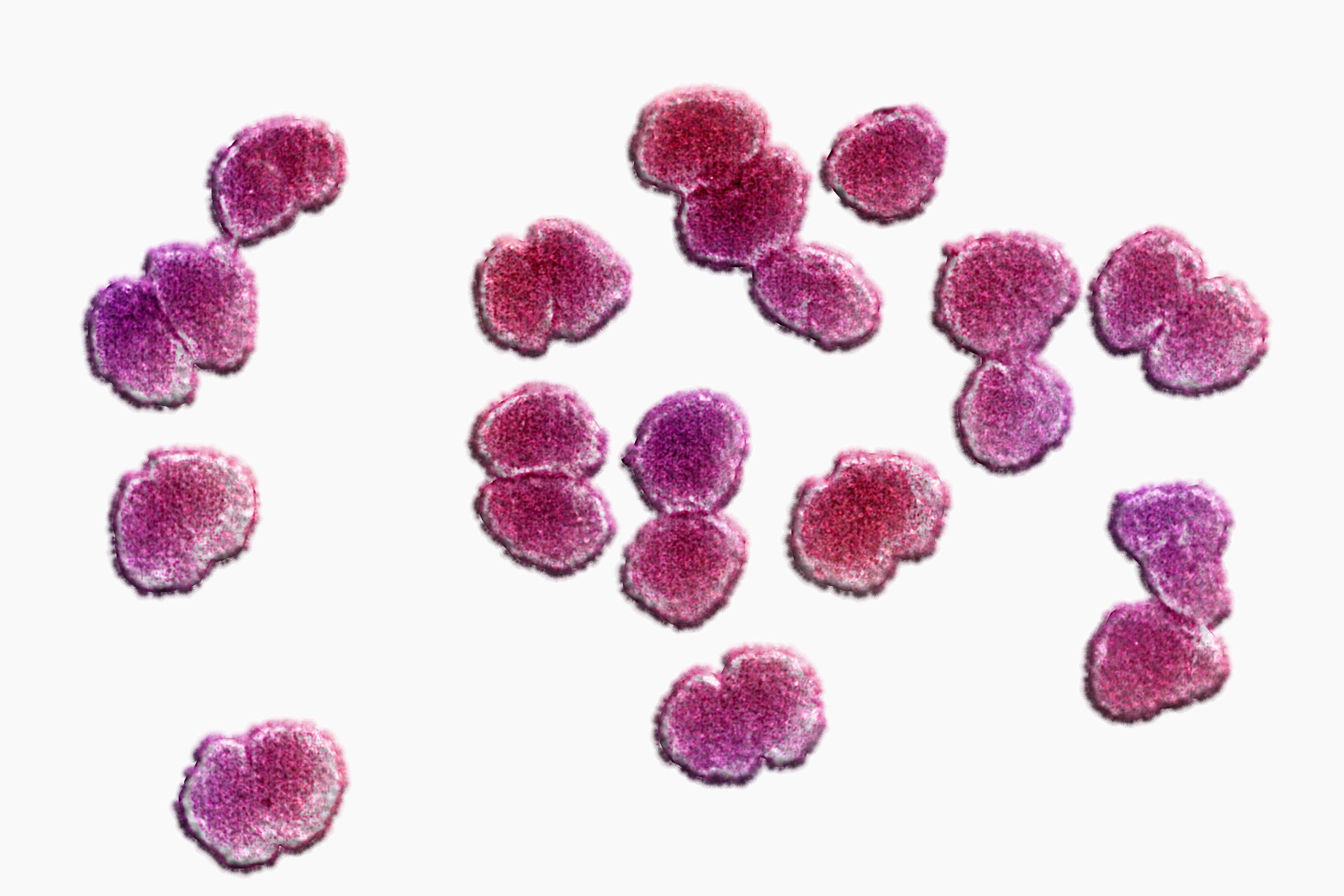 How Exactly Are STDs - Image 13 from Safe Sex Savvy: Everything You ...