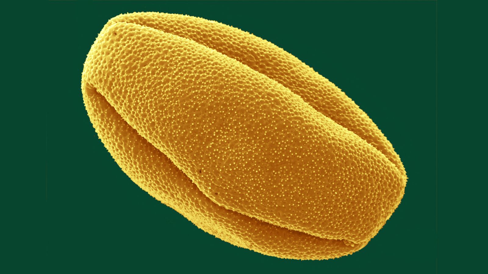 Ricin: A Bioterror Agent With Few Real Victims | News | BET