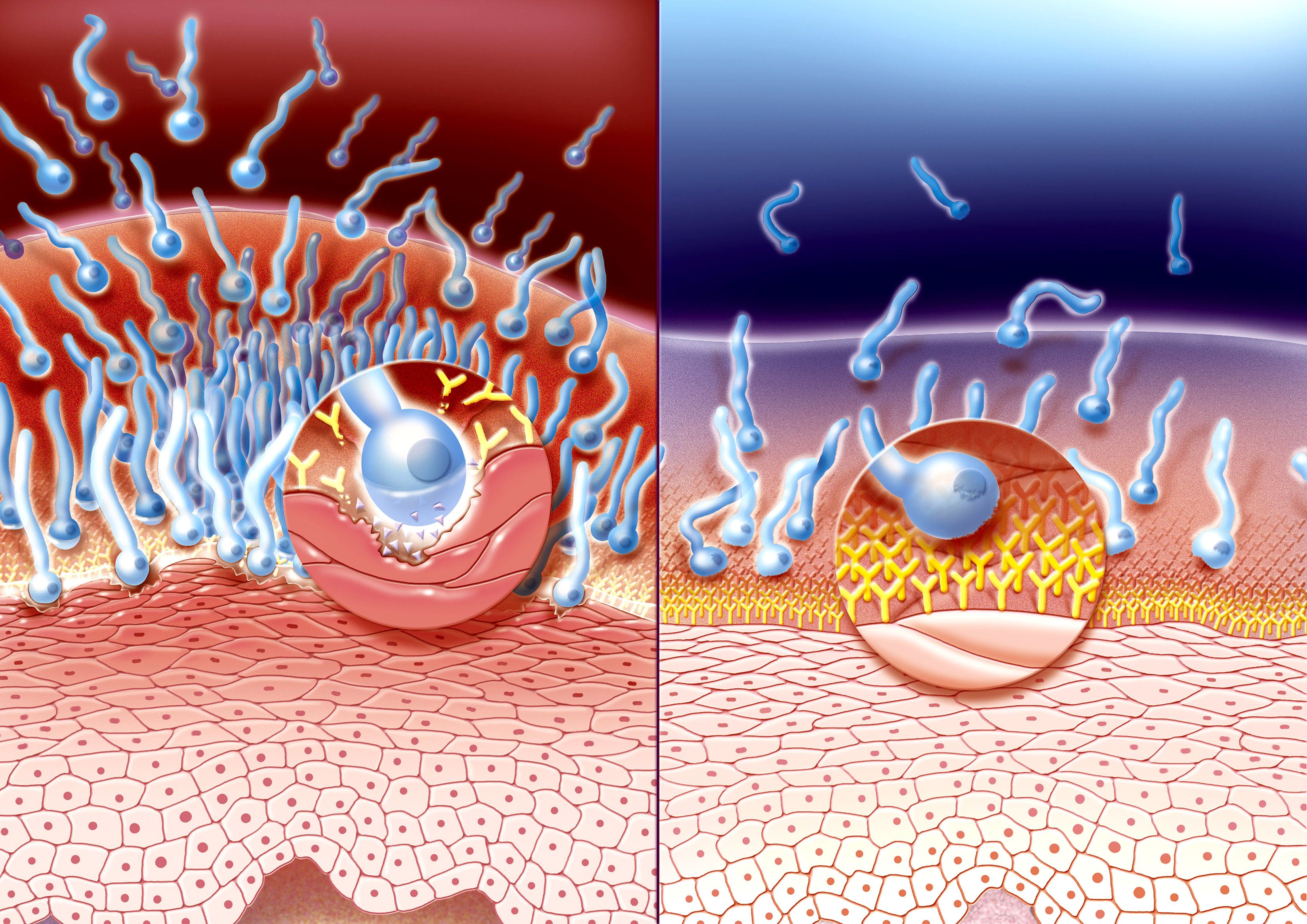What’s a Vaginal Yeast - Image 2 from Ugh: The Deal With Yeast ...