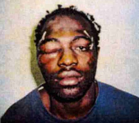Rodney King - The - Image 2 from Photos: Cases of Police Brutality | BET