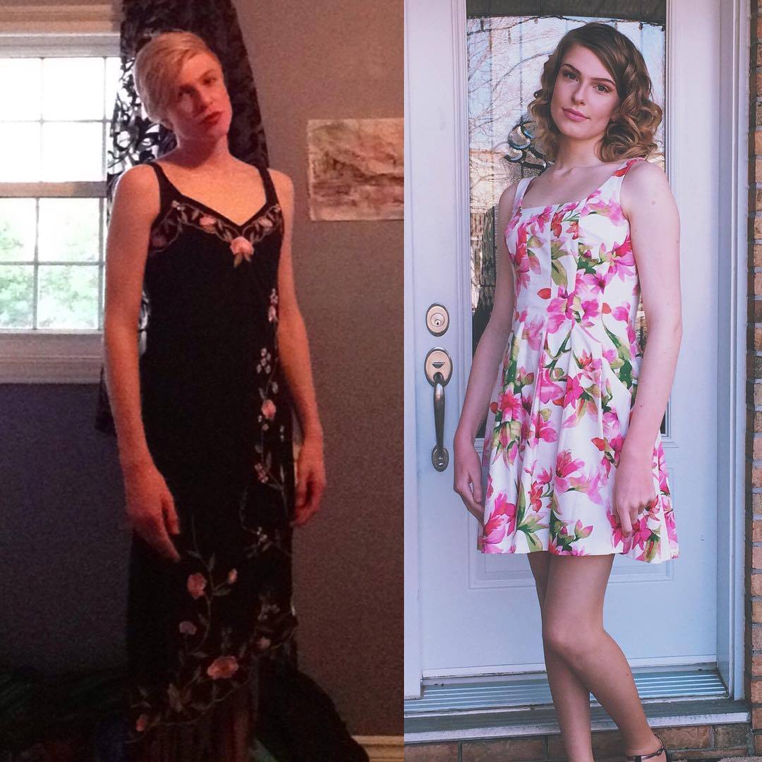 [Photos] Transgender Teens are Sharing Their Journeys With a Viral ...