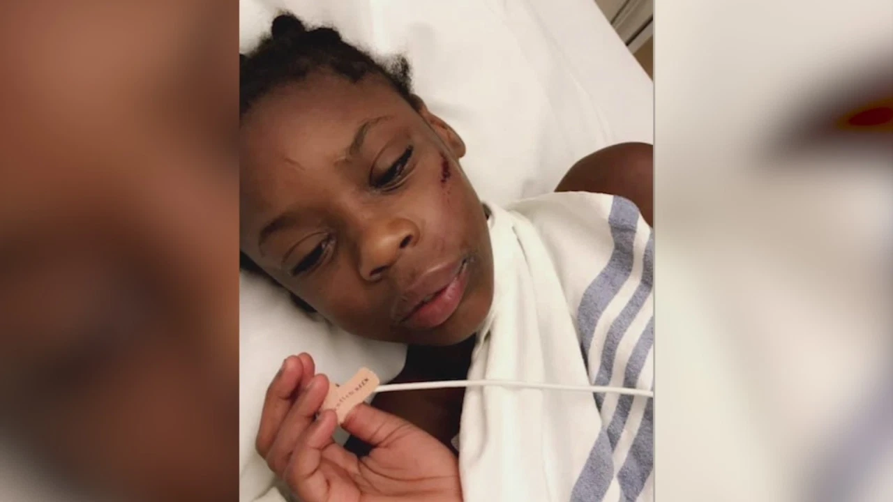 Black Girl Called Racial Slurs And Attacked With A Pole News Bet