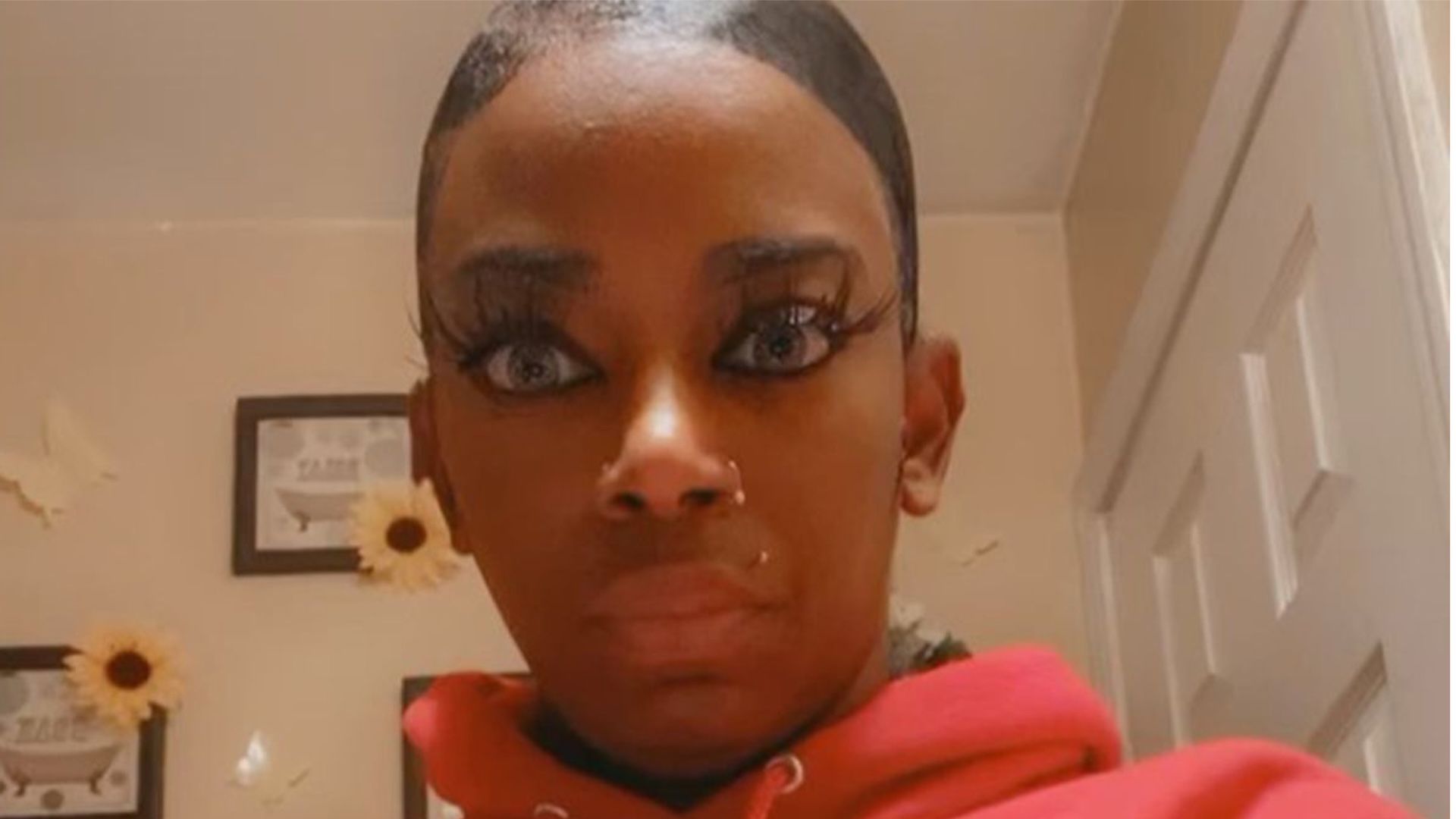 Gorilla Glue Woman Discovers Lumps in Breasts During Plastic Surgery ...