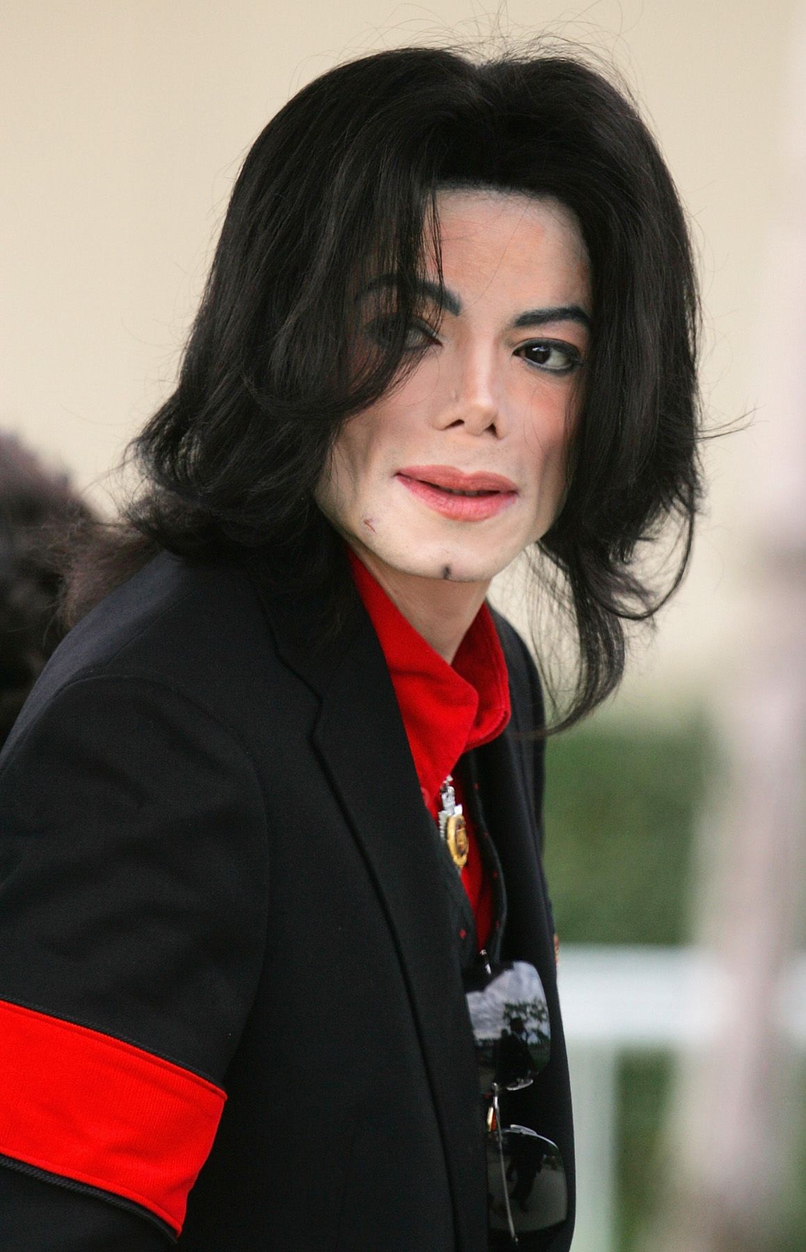 No One Is Exempt - Image 11 from The 411 on Vitiligo | BET