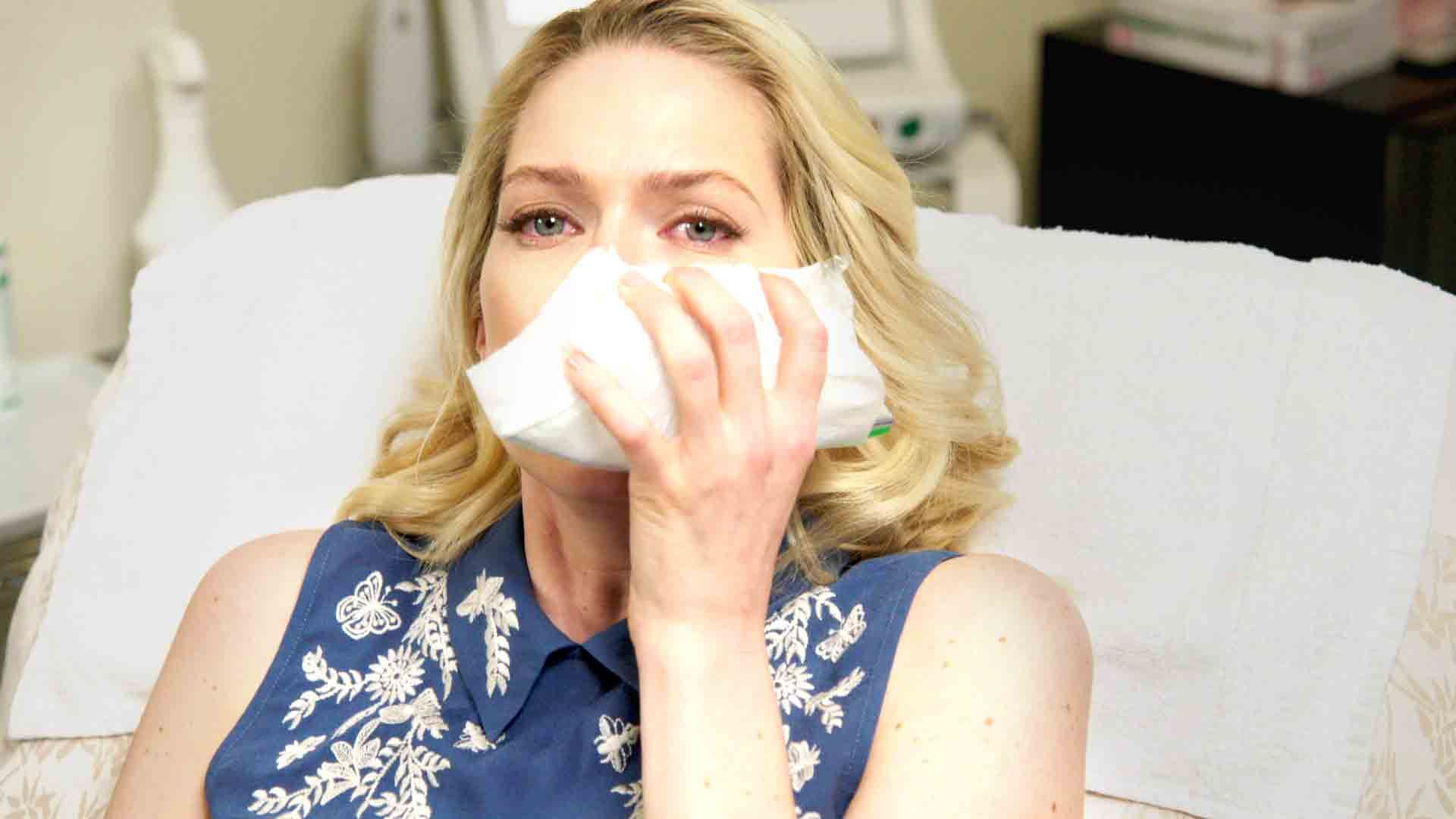 Erin's Lip Injection Gone Wrong - Barely Famous (Video Clip) | VH1